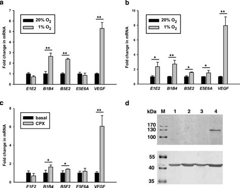 The Expression Of Cns Specific Ppargc1a Transcripts Is Regulated By Hypoxia And A Variable Gt