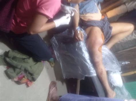 စစ်ကိုင်းမှာ လက်နက်ကြီးထိလို့ ဒေသခံ ၃ ဦးဒဏ်ရာရ