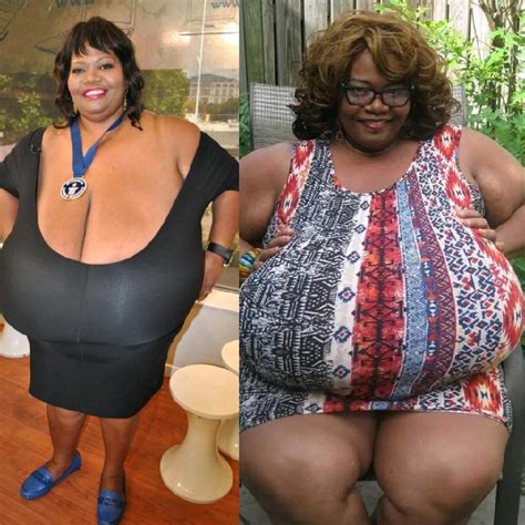 Woman With Worlds Biggest Breasts Says Shes Constantly Attacked By