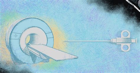 What Is A Prostate Biopsy Like Heres My Experience