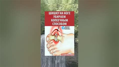 народнаямедицина народныерецепты долголетие здоровье медицина здоров зож полезныесоветы