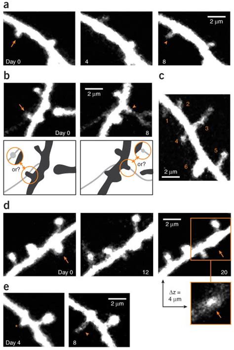 Long Term High Resolution Imaging In The Mouse Neocortex Through A Chronic Cranial Window