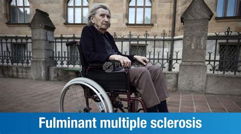 Fulminant Multiple Sclerosis Plexus