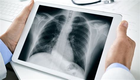 A Brief Overview Of Radiology CPT Codes