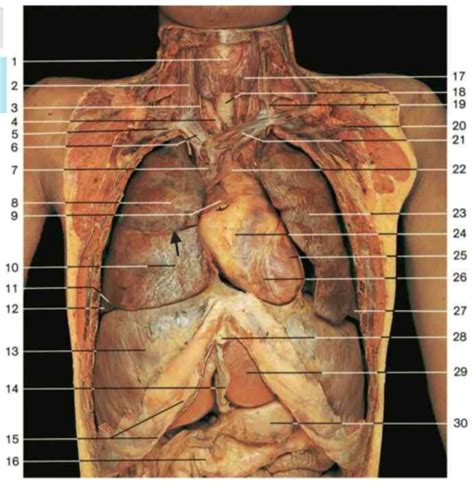 Anatomy Practical Rd 2 Flashcards Quizlet