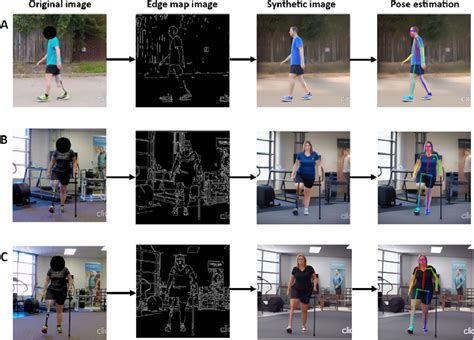 Figure From Diffusion Models Enable Zero Shot Pose Estimation For Lower Limb Prosthetic Users