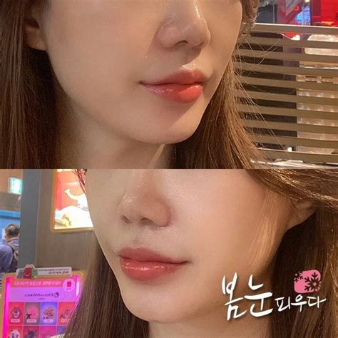 봄눈피우다의원 가로길이가 긴 시원한 입매 디자인하기💋 ⠀ 입술필러 시술의 장점 중 하나 바로 Facebook