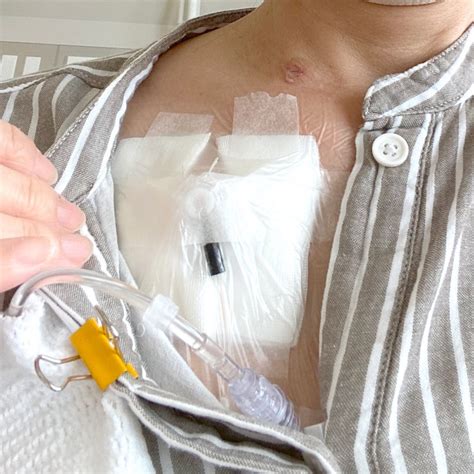 Cvポートその後 岡山 整理収納アドバイザー 小児科看護師 Yoko【余白】