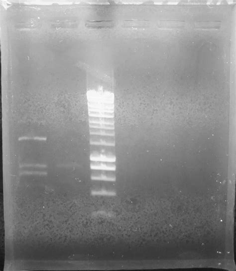 Questions With Answers In PLASMIDS Science Topic