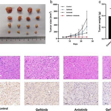 Anlotinib Reversed The Egfrtki Resistance In Vivo A Pc9gr Cells