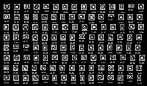 Flow Imaging Microscopy Identifying Subvisible Particulate In Biotherapies Proteinaceous Or