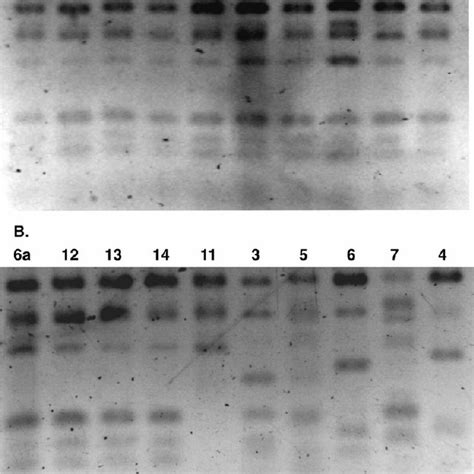 Similarity Analysis Of RFLP Patterns Download Scientific Diagram