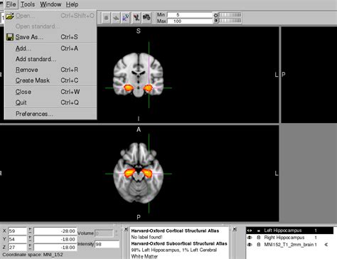 ROI Analysis Wei S Menu For Neuroimage 0 0 1 Documentation