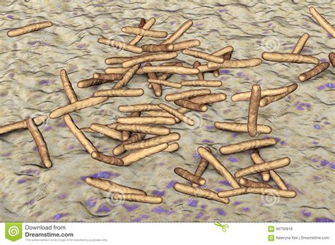 Mycobacterium Avium Intracellulare Non Tuberculous Mycrobacteria Stock Illustration