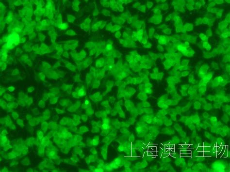 RM 1 LUC GFP Puro Clone双标记的小鼠前列腺癌细胞 企业官网