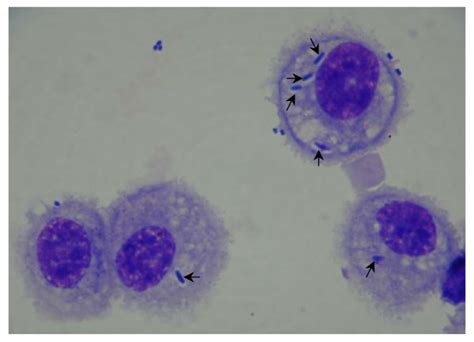 Microscopic View Of Mouse Alveolar Macrophages With K Pneumonia Download Scientific Diagram