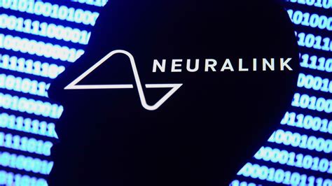 Elon Musks Neuralink Could Be Trialed In Humans In 2023 Heres What You Need To Know
