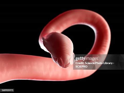 What Is Round Worm Photos And Premium High Res Pictures Getty Images