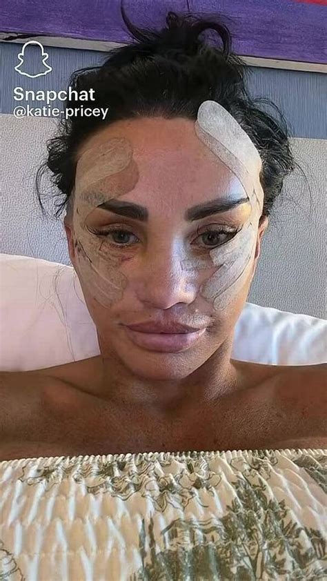 Katie Price Shows Painful Result Of Latest Face Lift In Bandaged