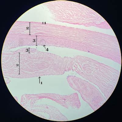 Histología Funcional VÁlvula Auriculoventricular
