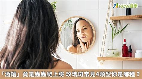 「酒糟」竟是蟲蟲爬上臉 玫瑰斑常見4類型你是哪種？ Now健康 Line Today