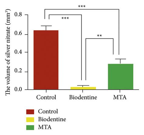 Microleakage Evaluation By A Micro Ct Analysis A Micro Ct Images Download Scientific Diagram