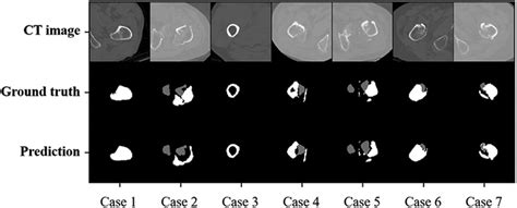 Automatic And Manual Labeled Masks In Local Test Dataset Download Scientific Diagram
