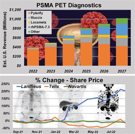 Bob Williams On Linkedin Psma Pet Diagnostic Pylarify Illuccix