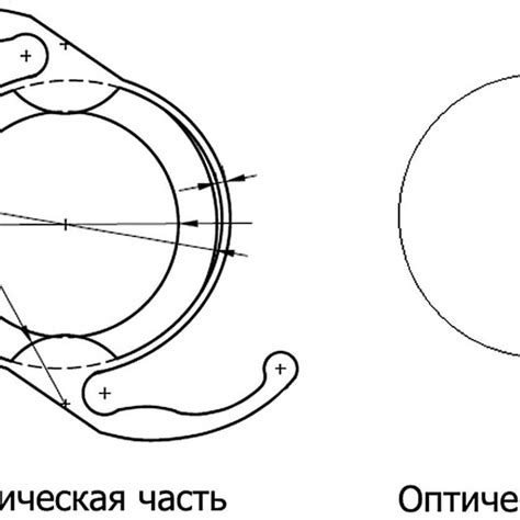 fig schematic representation of modular iol components haptic and