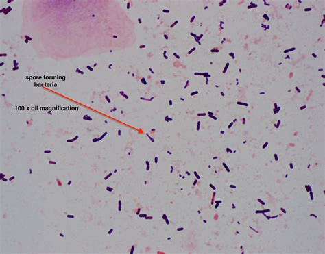 Clostridium Botulinum Gram Stain