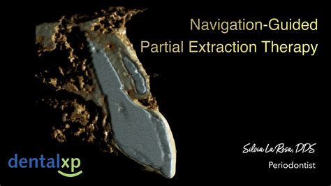 Online Dental Ce Webinars And Events Video Null Dentalxp