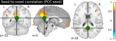 Nilearn Statistical Analysis For Neuroimaging In Python — Machine
