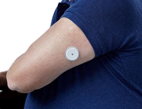 Abbott Glucose Monitor Patch At Roger Krug Blog