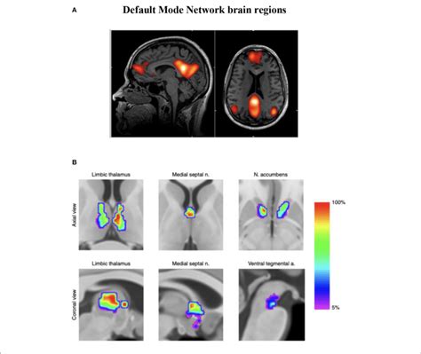 A Functional Mri Demonstration Of The Default Mode Network Dmn Download Scientific