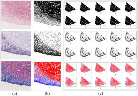 Collagen Quantification By The Color Deconvolution With Serial Wsis Of Download Scientific