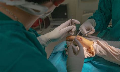 Prolene Suture Absorption Time Reliable Sutures Manufacturer