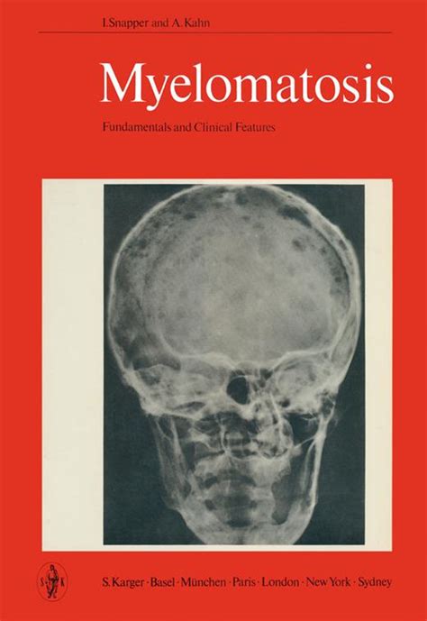 7 Polyclonal Hyperglobulinemia Myelomatosisfundamentals And Clinical Features Books Gateway