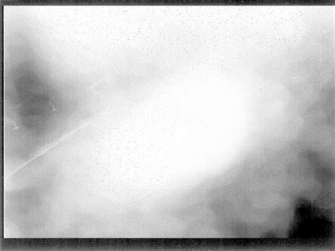 Unwrapped Phase Map Of Figure 2 Obtained By The Unweighted Algorithm Download Scientific Diagram