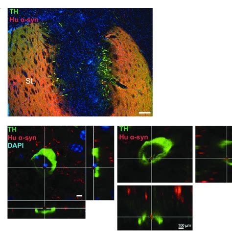 Pathology Propagation In A Model Of α Syn Preformed Fibrils Injection