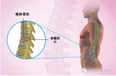 显微成像助力脊髓损伤后的轴突再生和功能恢复研究新进展 生物器材网