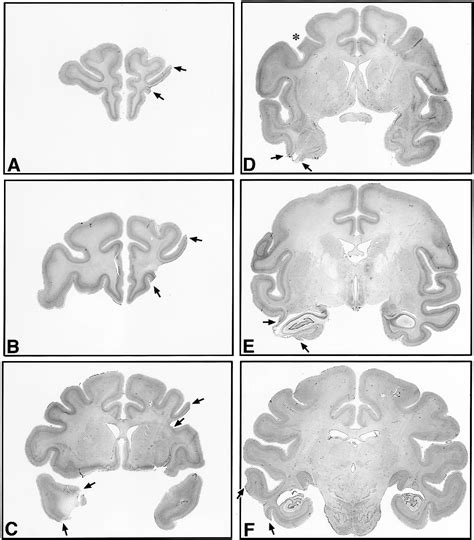 Figure 1 From Interaction Of Ventral And Orbital Prefrontal Cortex With Inferotemporal Cortex In