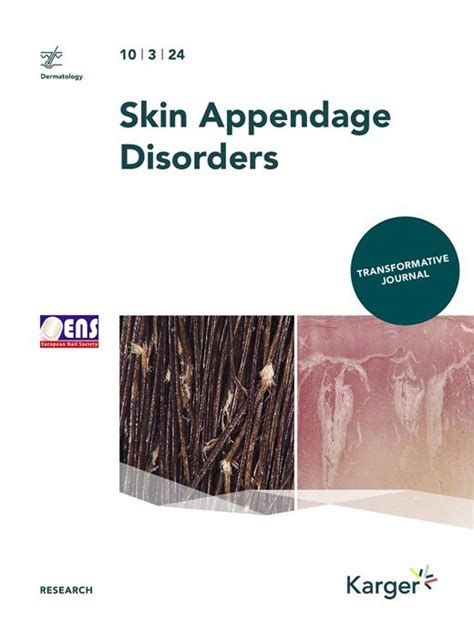 A Case Of Dissecting Cellulitis Of The Scalp Hidradenitis Suppurativa