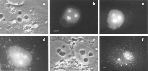 Figure 2 From Dynamic Localization Of Rnase Mrp Rna In The Nucleolus Observed By Fluorescent Rna