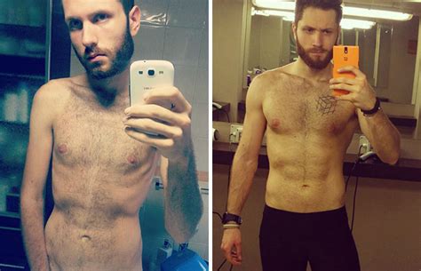 Anorexia Before And After Photos Of Anorexia