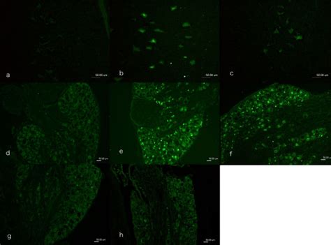 Immunocytochemical Staining Of Atf3 In Motor Neurons In Spinal Cord Download Scientific Diagram