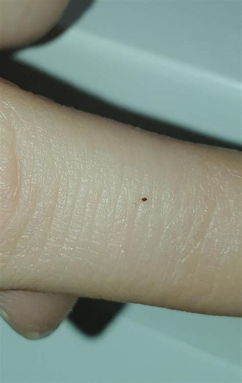 What Is This Translucent Bug And How Do I Get Rid Of Them They Are On My Syngonium Its