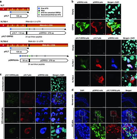 Protein Coding Potential Of Vlt Orf63 Fusion Transcripts A Schematic Download Scientific