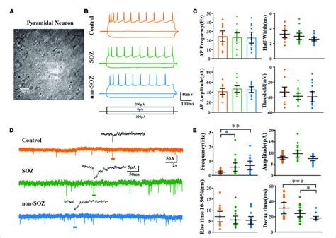 Electrophysiological Characteristics And Spontaneous Excitatory