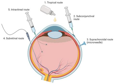 Ocular Medication Routes Of Administration Encyclopedia Mdpi
