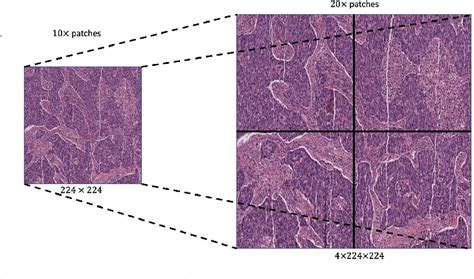 A Dual Branch Self Supervised Representation Learning Framework For Tumour Segmentation In Whole
